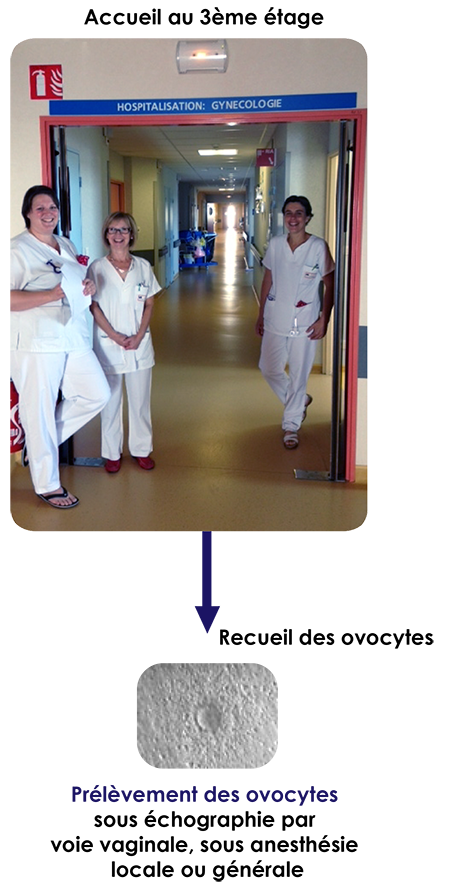 Etape 2: La ponction ovarienne | AMP CHU Dijon Bourgogne